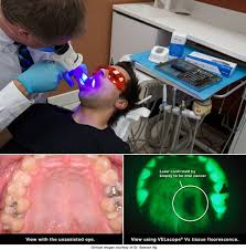 Oral Cancer Awareness: The Importance of VELscope Exam & Routine Dental Care