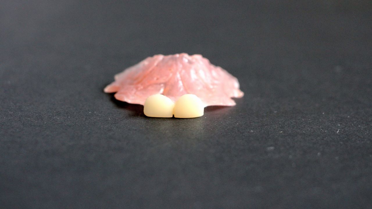 Flipper Teeth: What You Need to Know